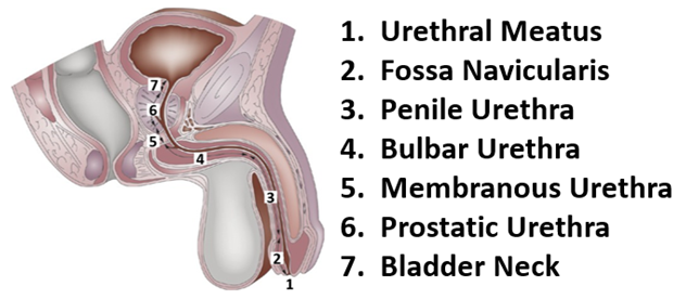 Medical Student Curriculum: Urethral Strictures - American Urological Association